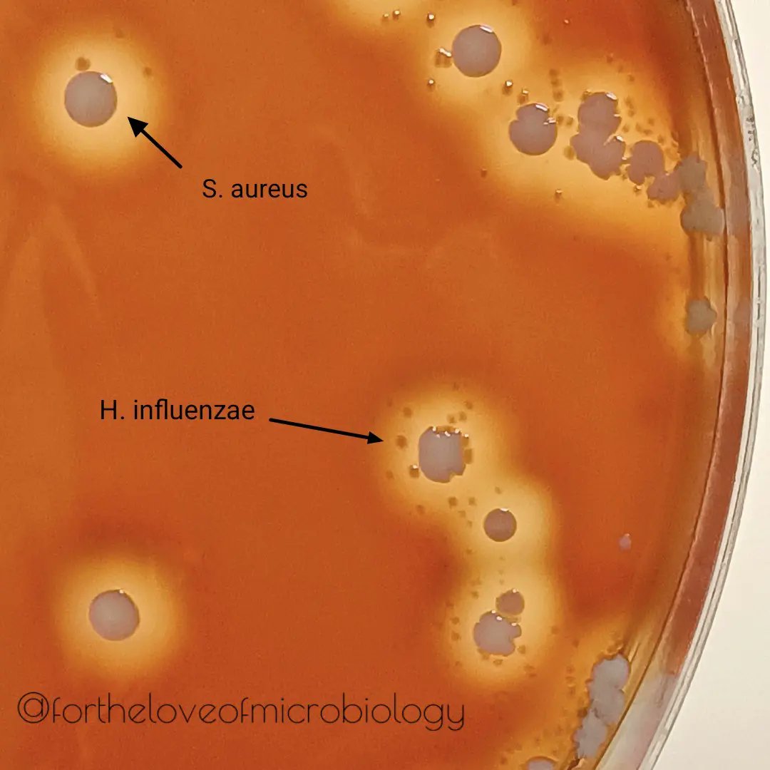 Haemophilus Influenzae Chocolate Agar