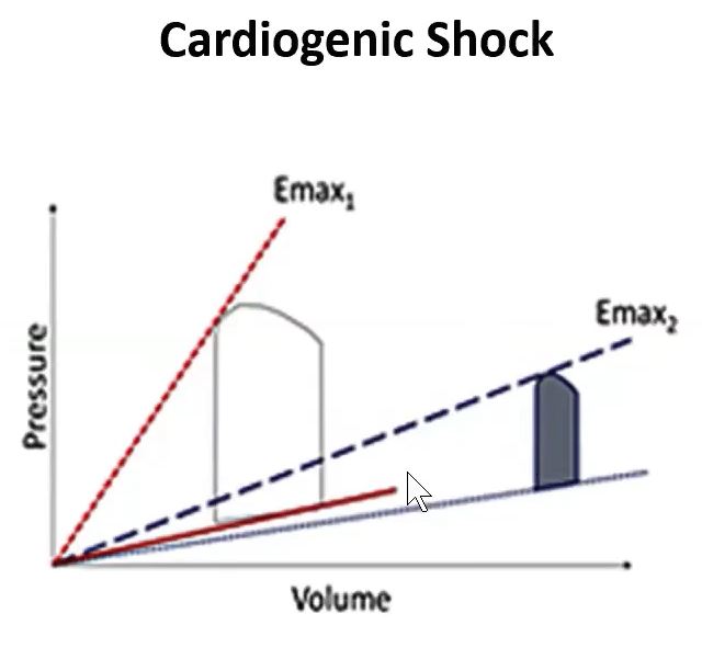 32. For Part 3 of our #Tweetorial on the basics of mechanical ...
