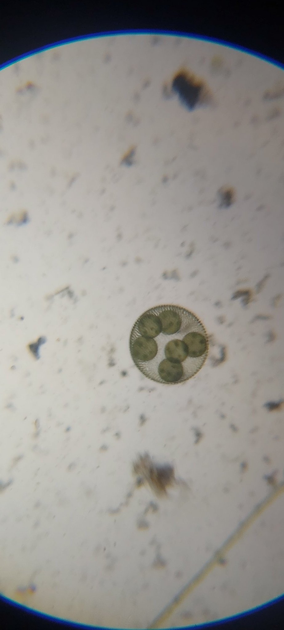 Volvox Under Microscope