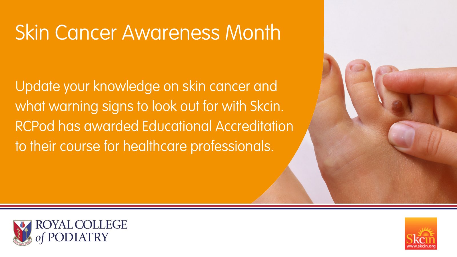 Skin Cancer Prevention And Early Detection