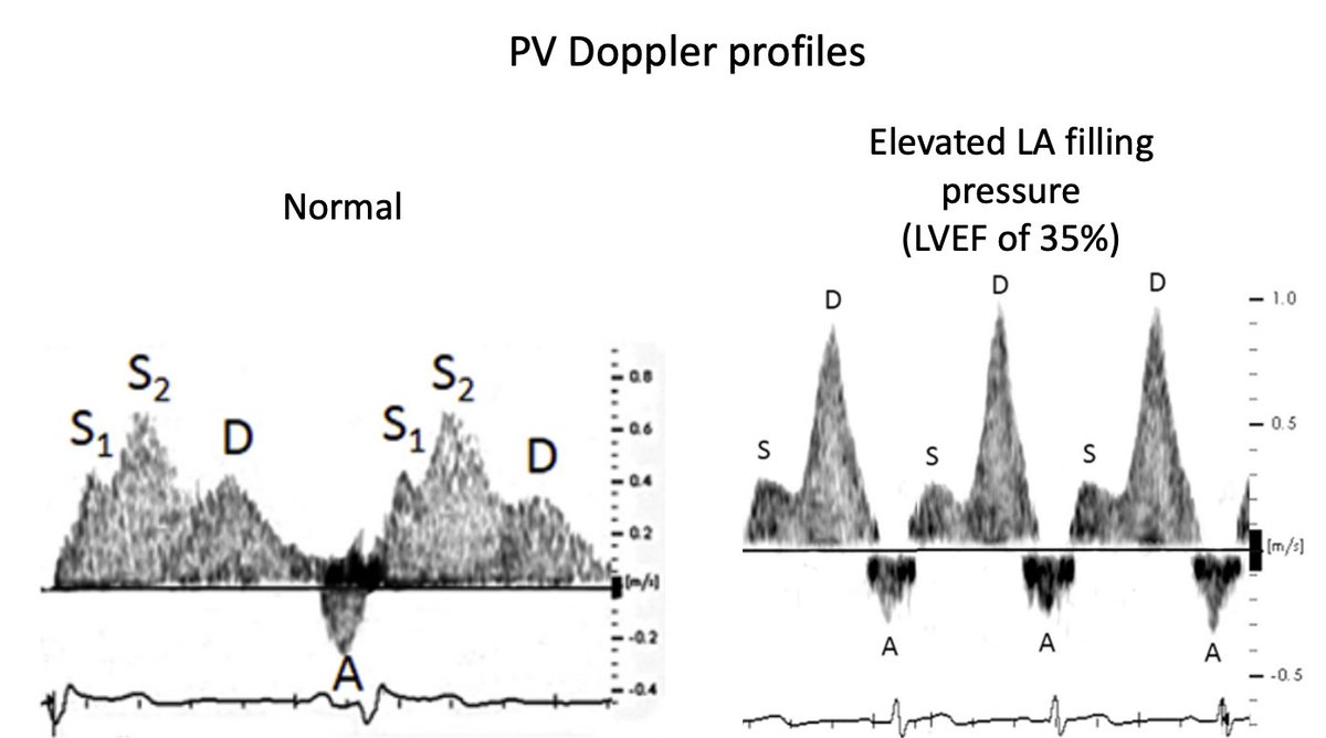 Where is this Doppler Waveform from? and, What can it tell us about ...