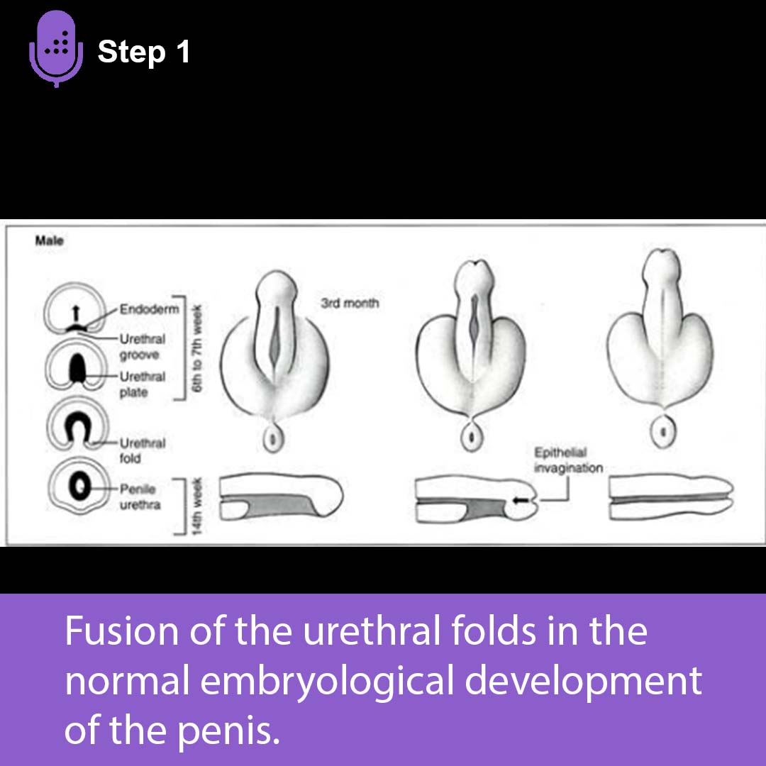 Urogenital Folds