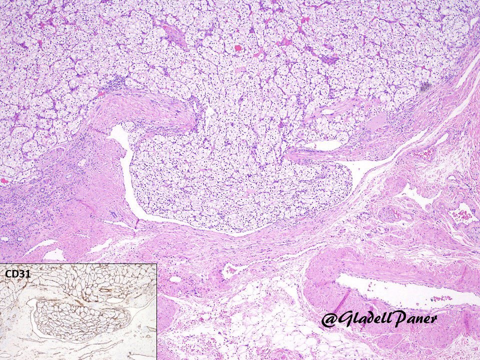 Renal Sinus Histology