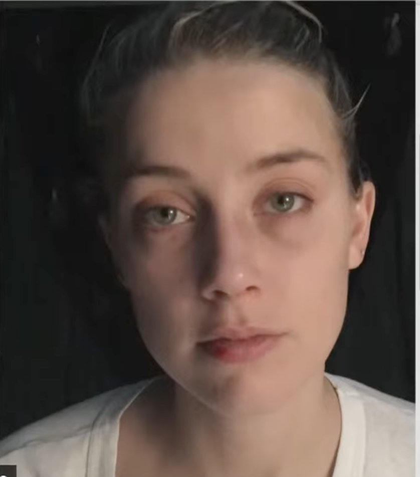 Rihanna Beat Up Face