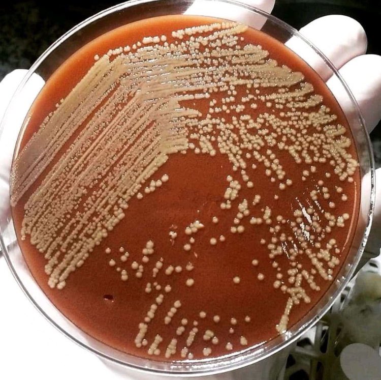 Chocolate Agar