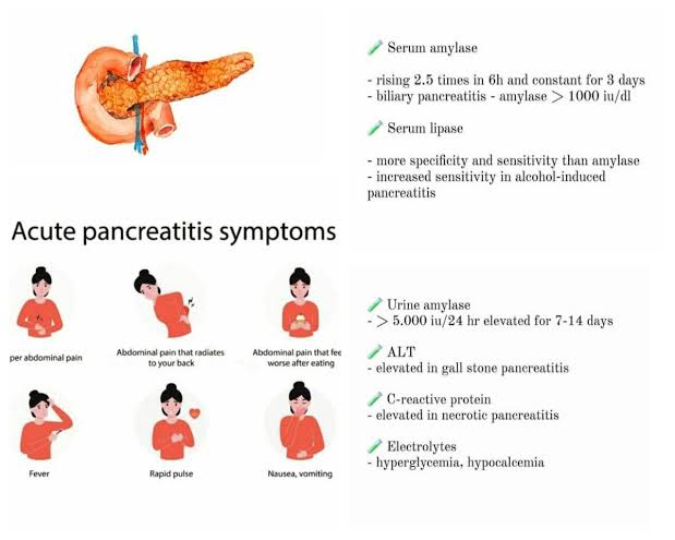 Acute Pancreatitis Signs And Symptoms