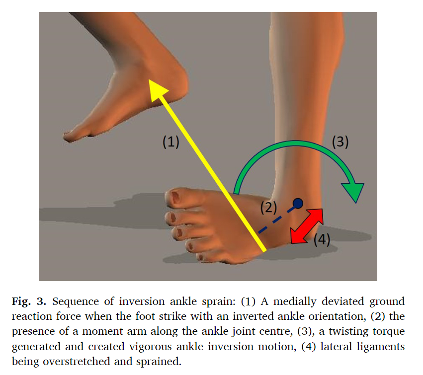 Inversion Of Ankle