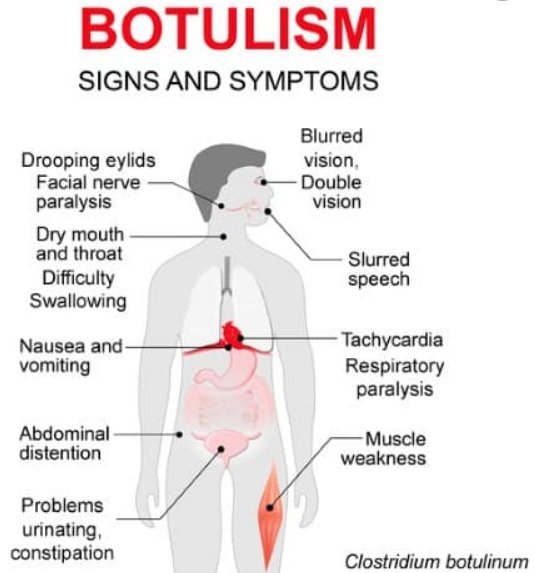 Clostridium Botulinum Diagram