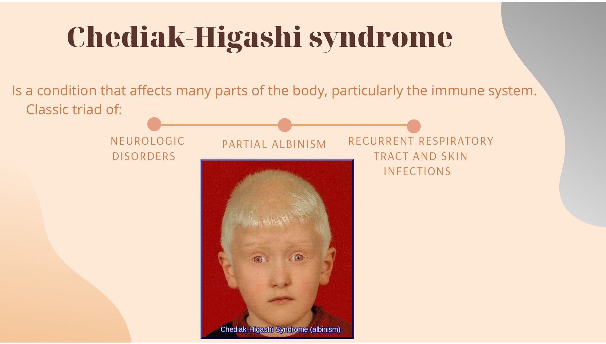 Chediak Higashi Syndrome