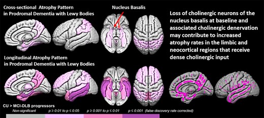 Nucleus Basalis Of Meynert Cross Section