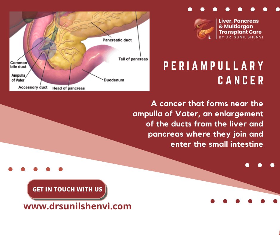 Pancreas Model Ampulla Of Vater