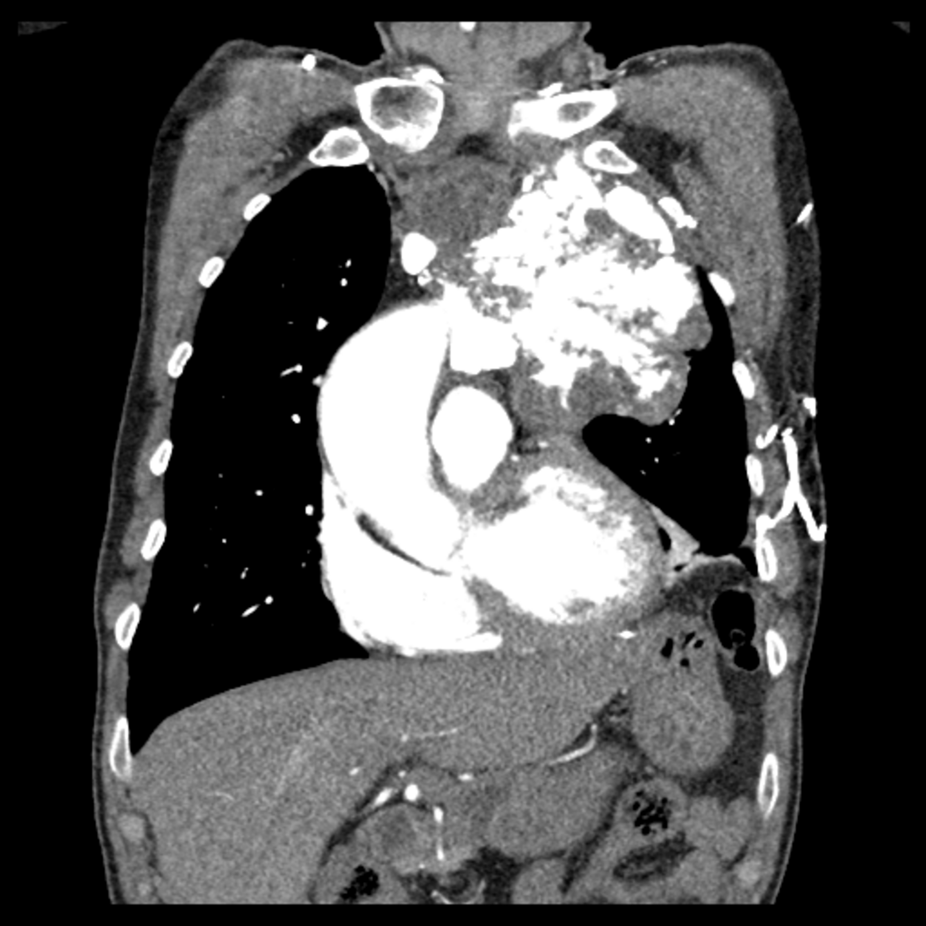 BIDMC Musculoskeletal Imaging & Intervention (@BIDMC_MSKImg) / Twitter