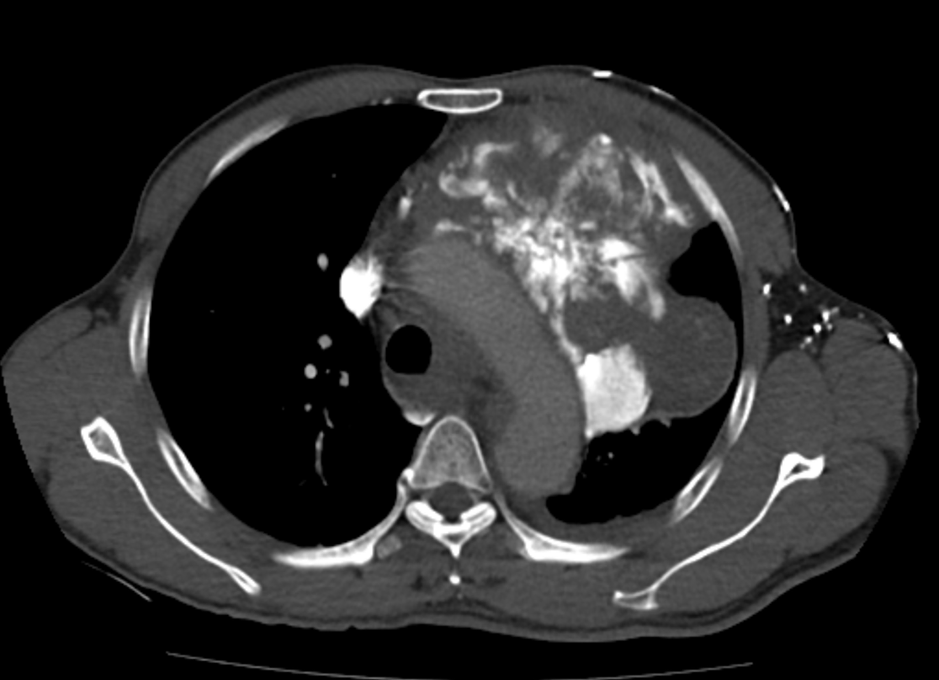 BIDMC Musculoskeletal Imaging & Intervention (@BIDMC_MSKImg) / Twitter