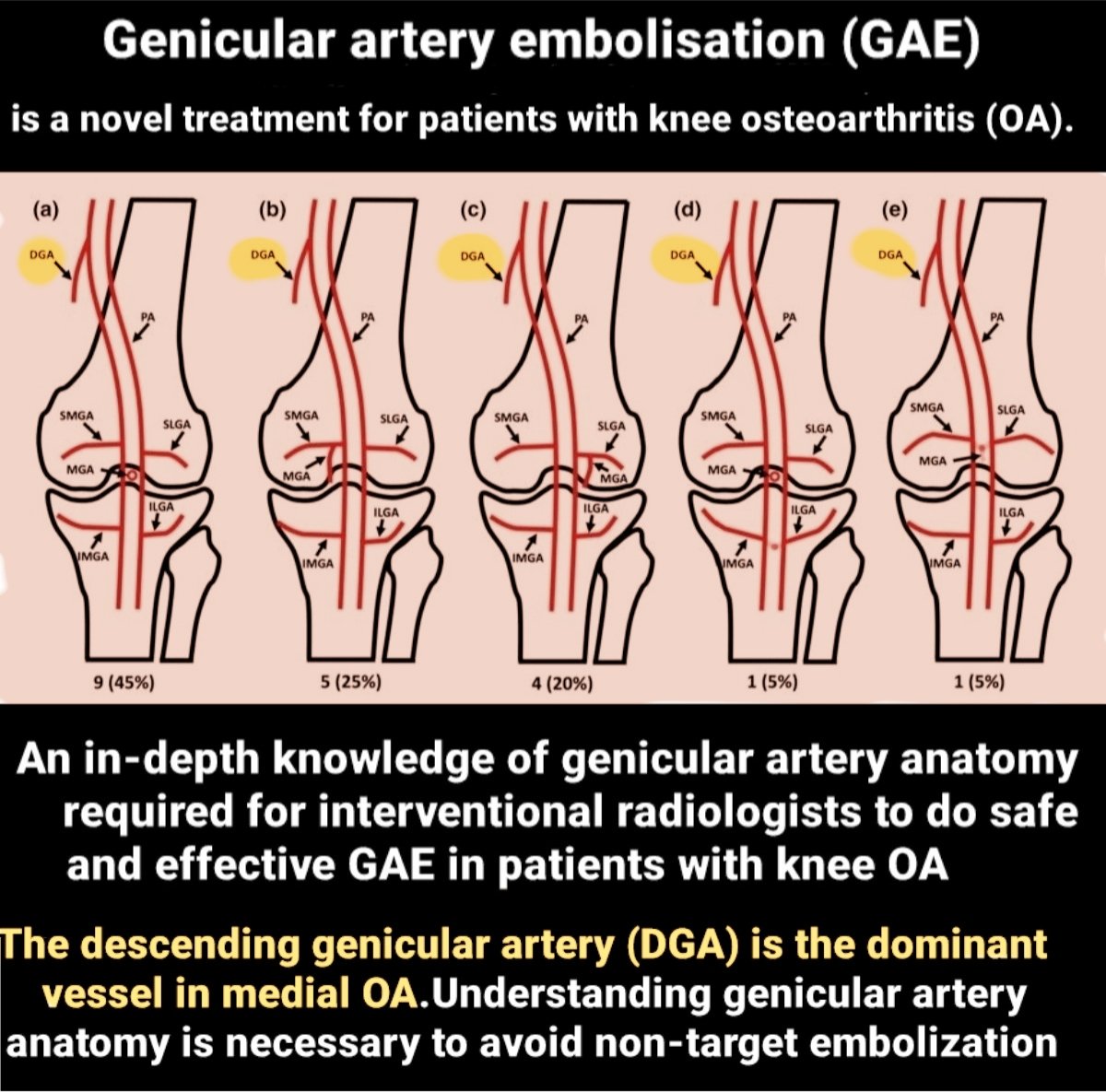 Descending Genicular Artery