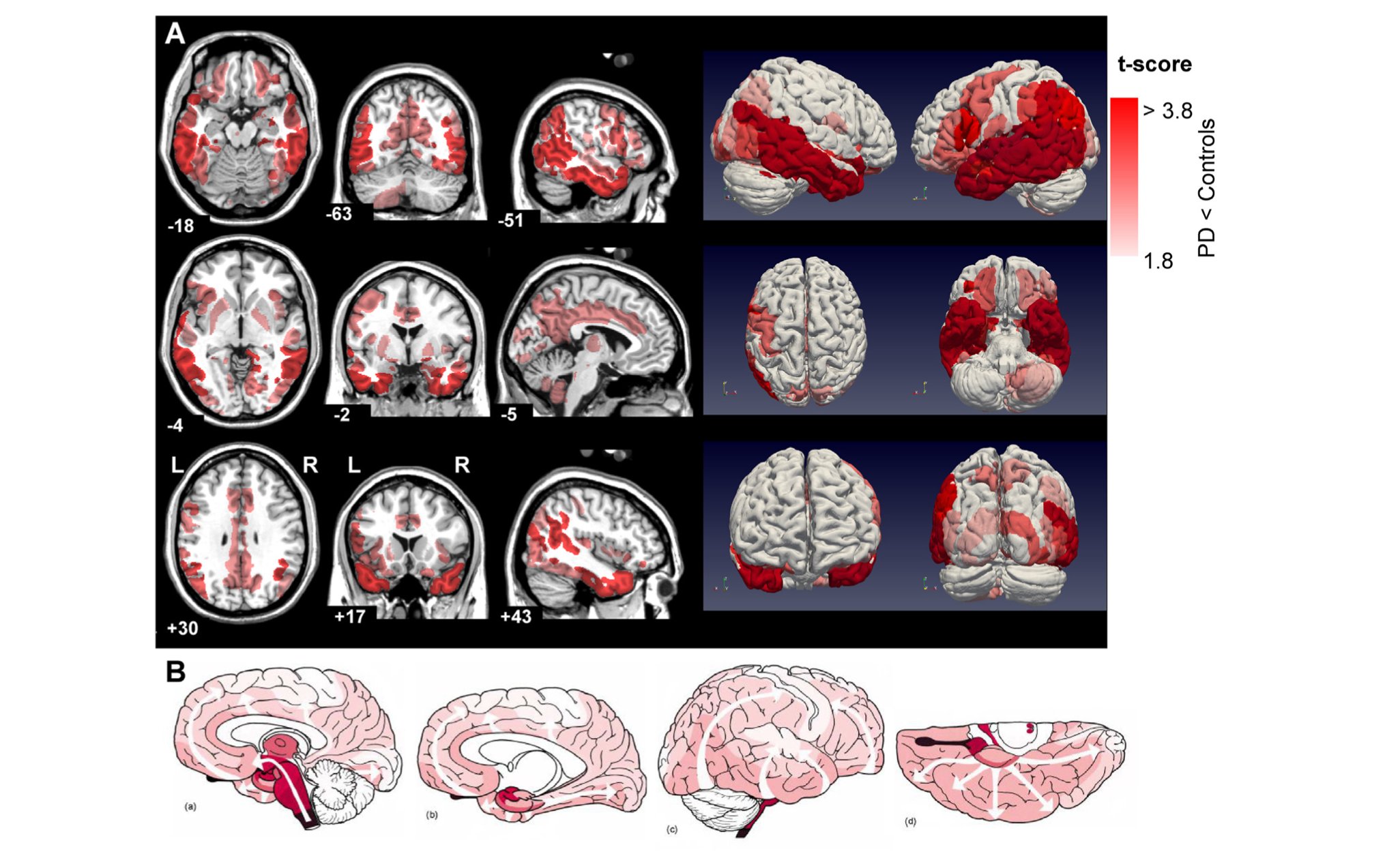 CORTEX on Twitter: "#ResearchReport Special Issue "Mapping sound to meaning under challenging ...