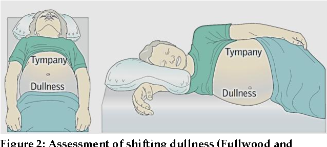 A patient presents with abdominal distension. What do you think is ...