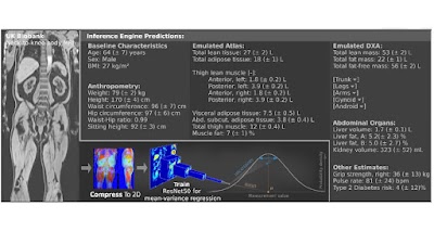 Radiology: Artificial Intelligence on Twitter: "#DeepLearning automatically measures 72 features ...