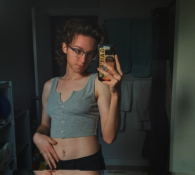 Coms Open On Twitter See The Curls Were Sexier But The Bald Is Also
