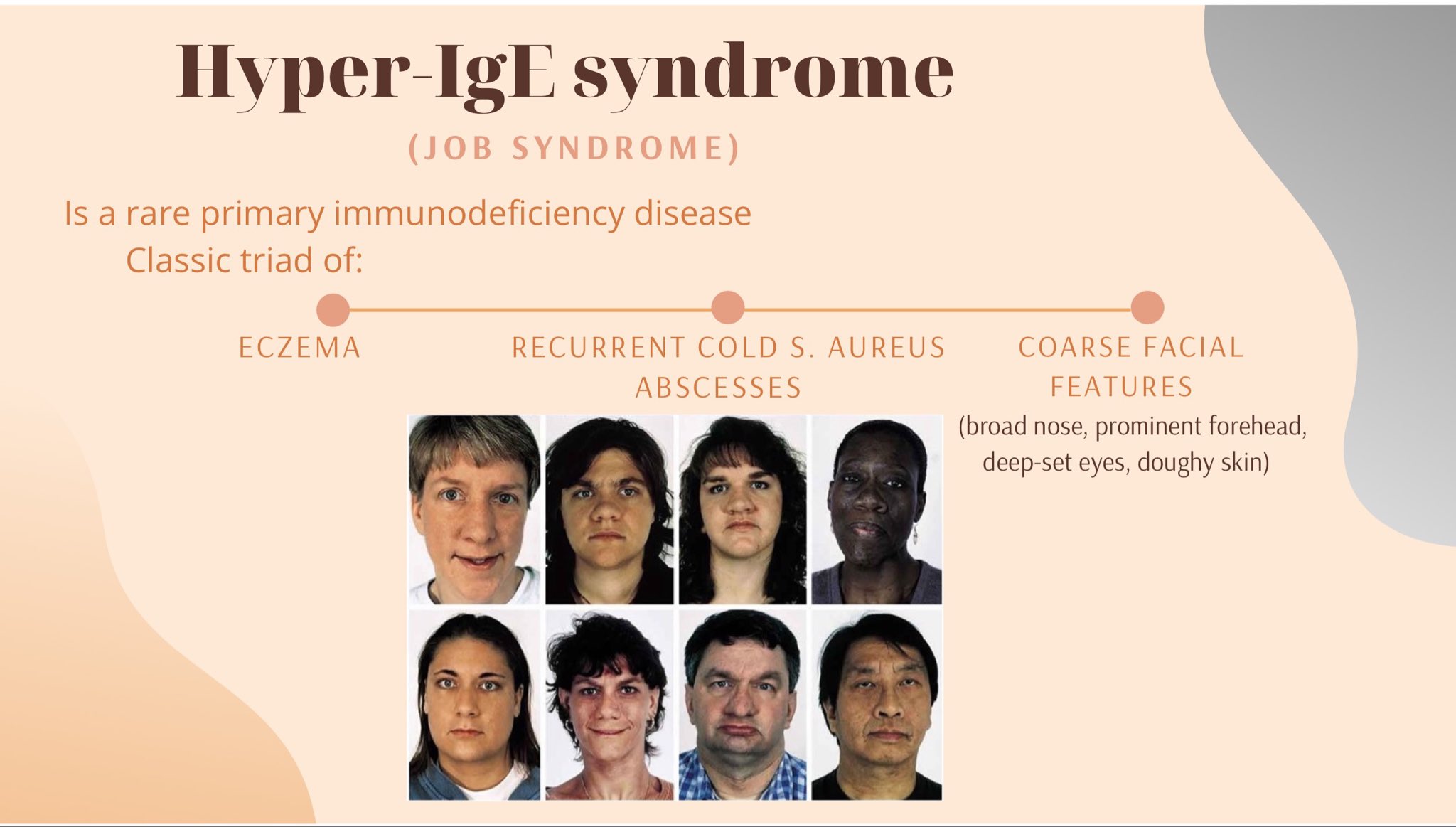 Jobs Syndrome Symptoms