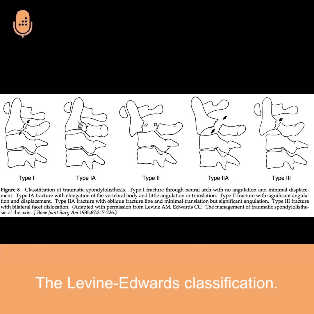 Hangman Fracture Classification
