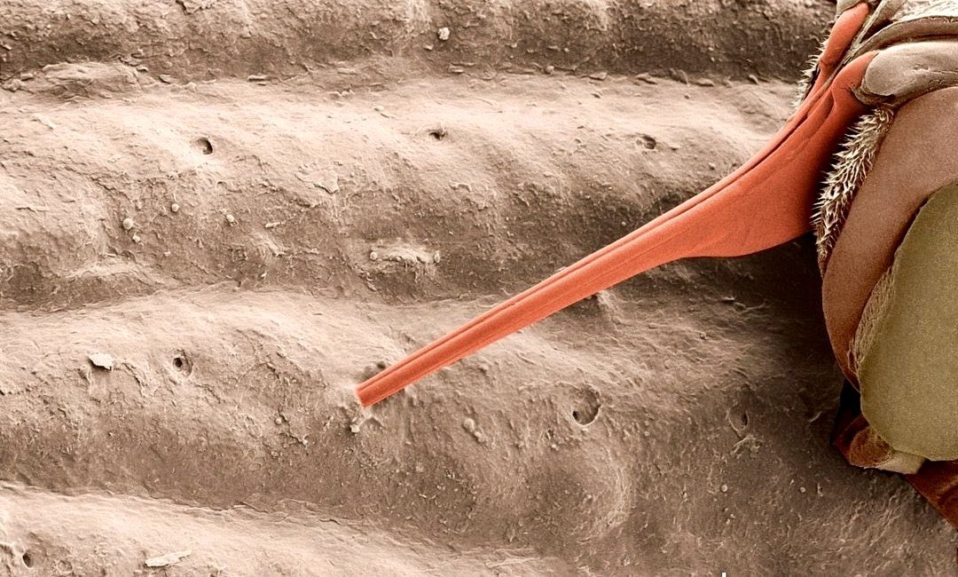 Bee Stinger Under Microscope