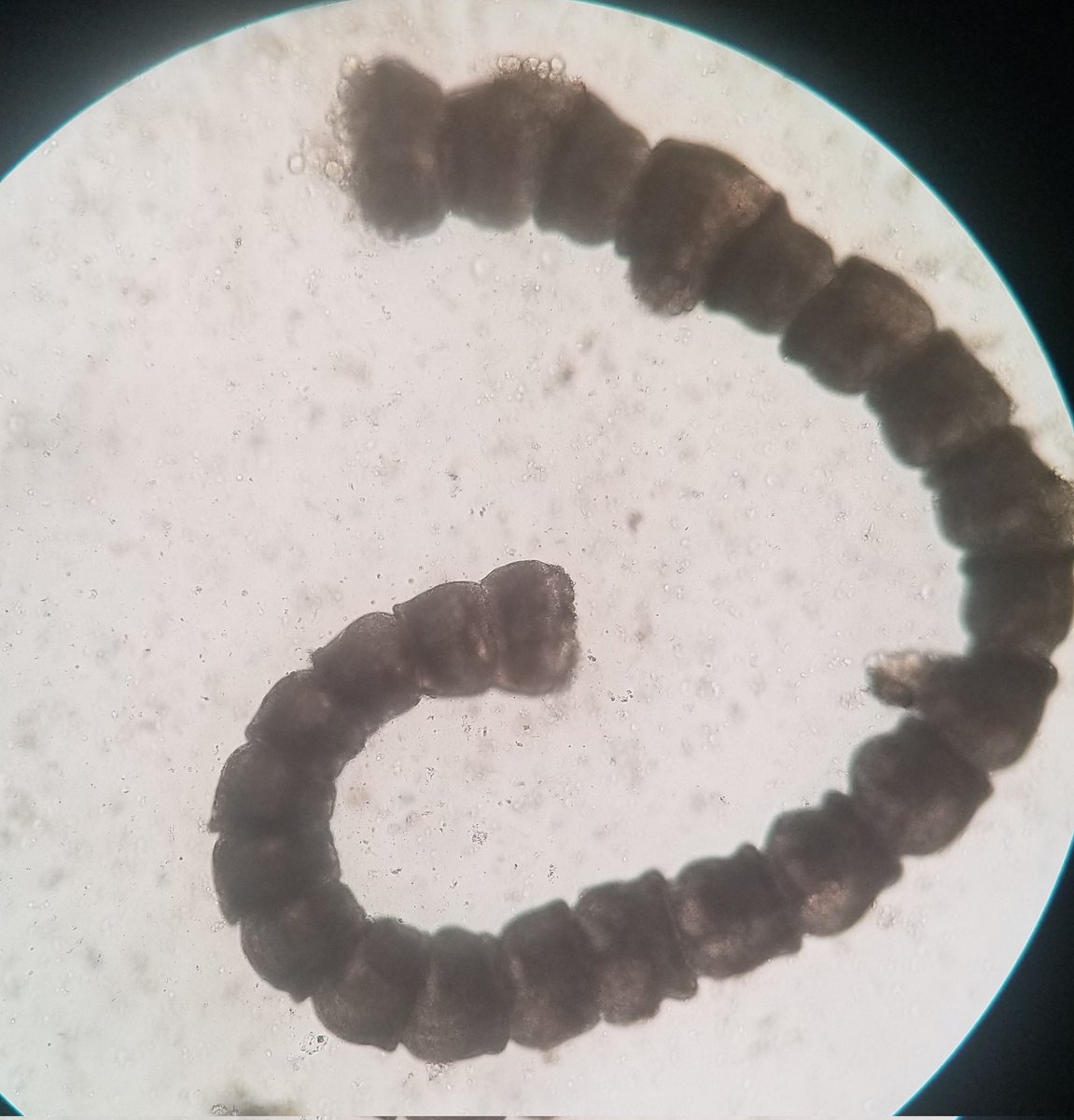 H.nana adult worm and immature egg. وسوف اضع لكم تحت صور لنفس الحالة ...