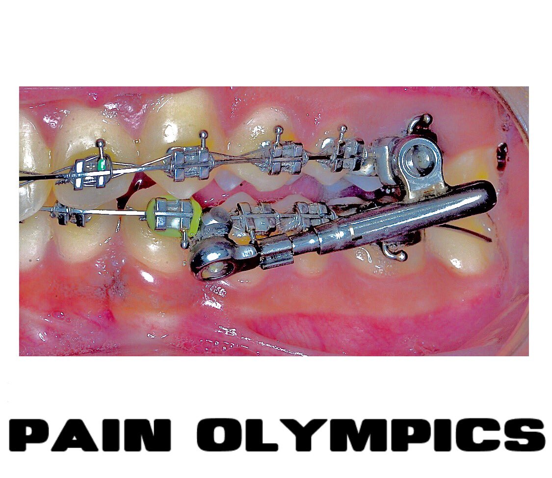 Pain Olympics