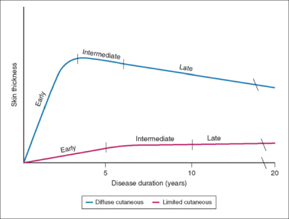 What is modified Rodnan skin scoring in #scleroderma? Scoring of 1️⃣7️⃣ ...