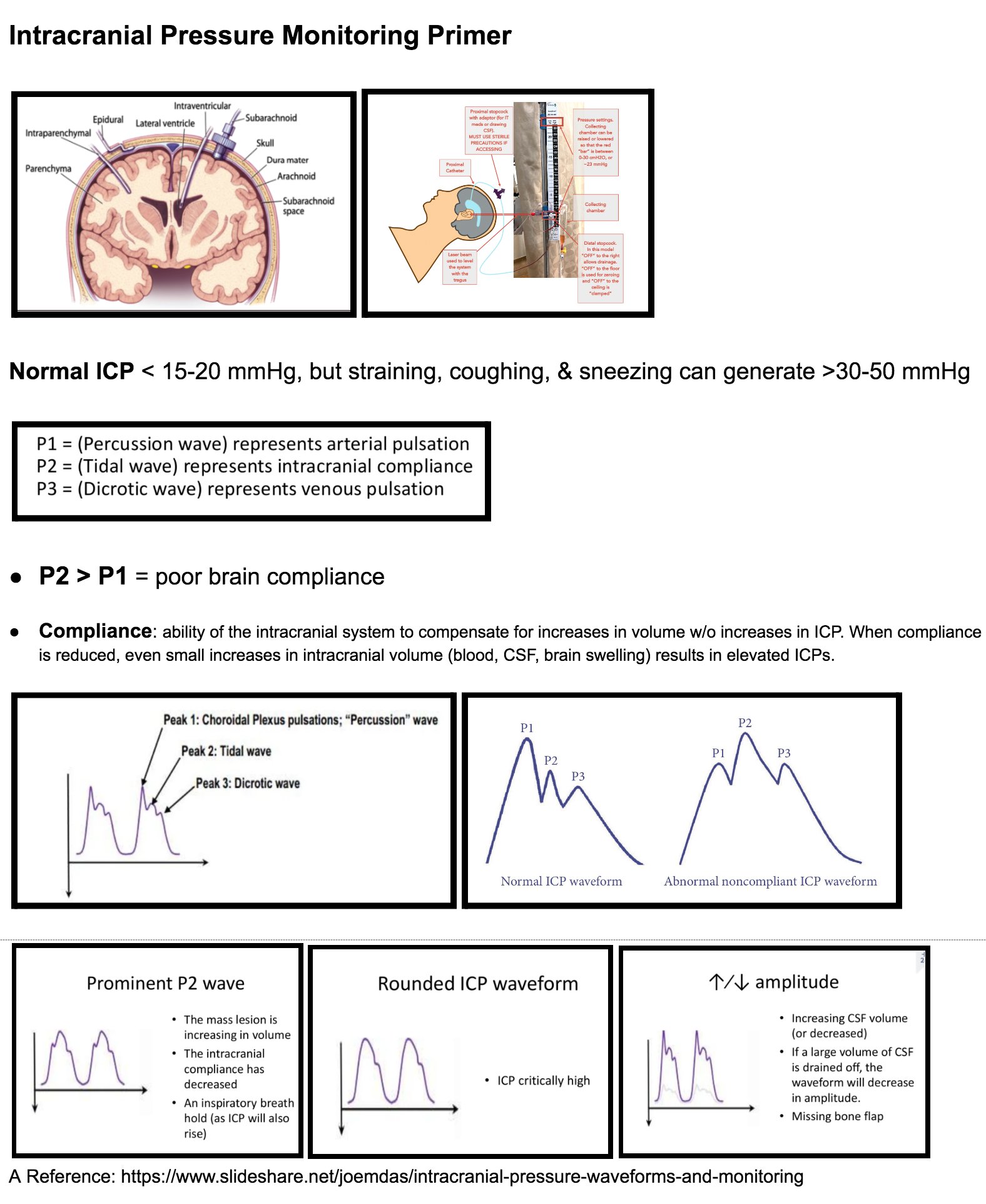 Intracranial Pressure Monitoring Chart Easy