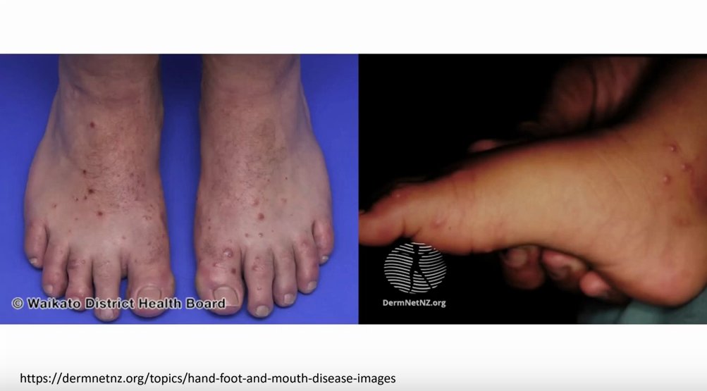 Thread by @KashPrime on Thread Reader App – Thread Reader App