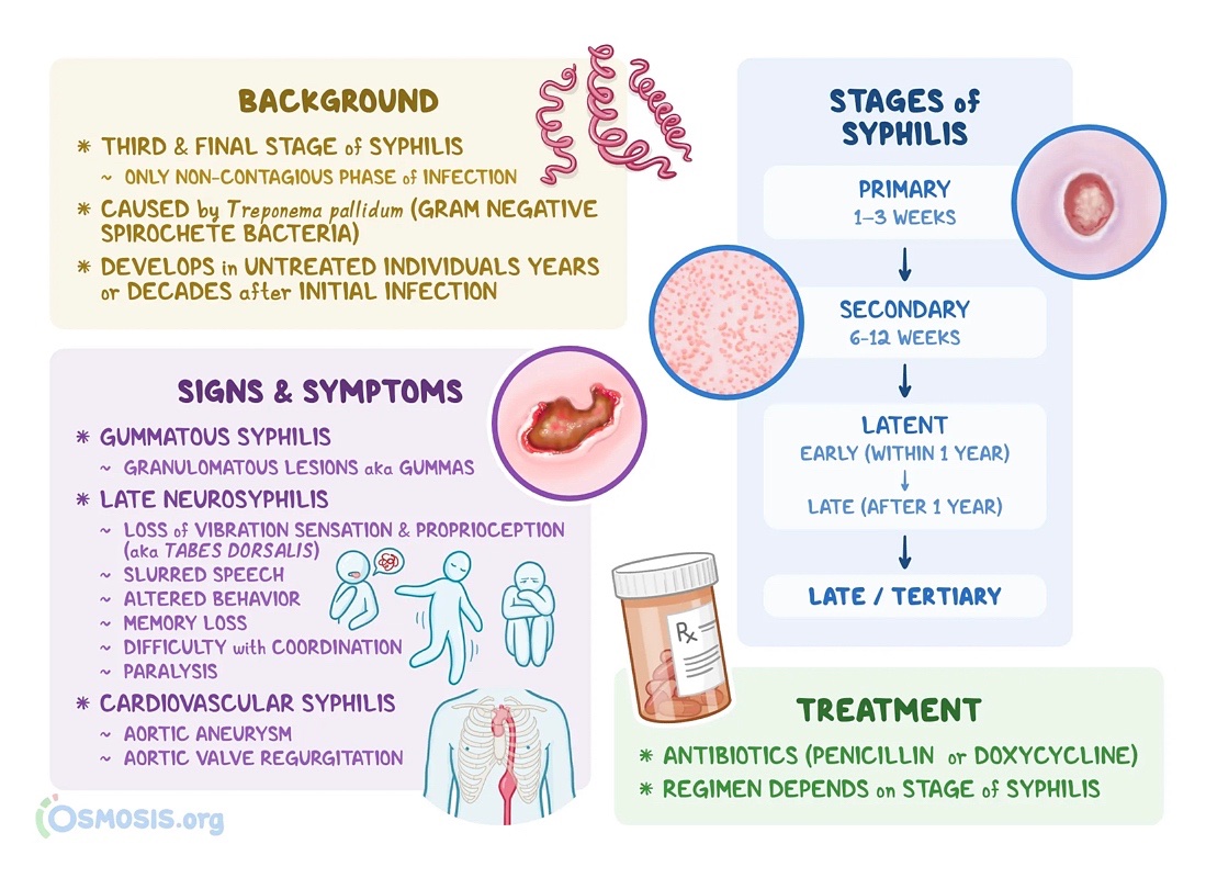 Cardiovascular Syphilis