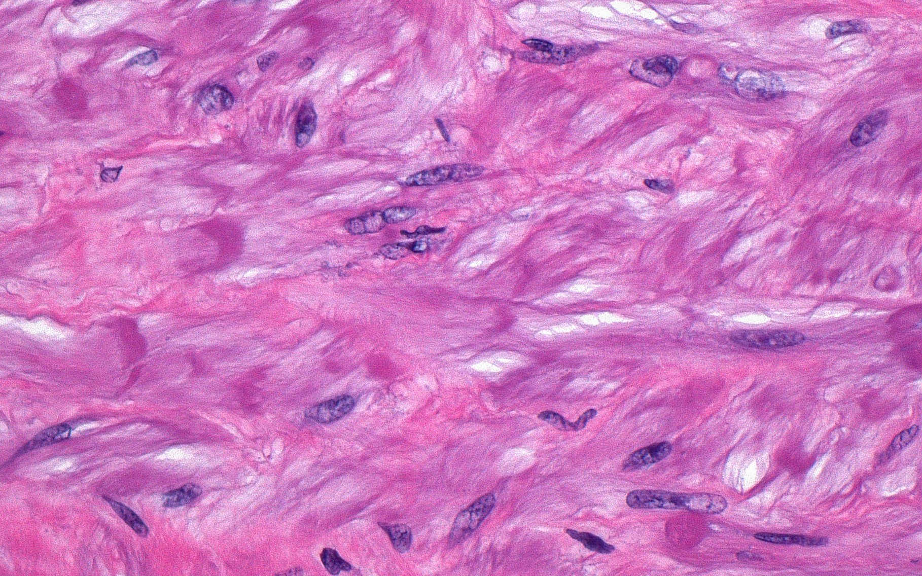 Smooth Muscle Cell Under Microscope