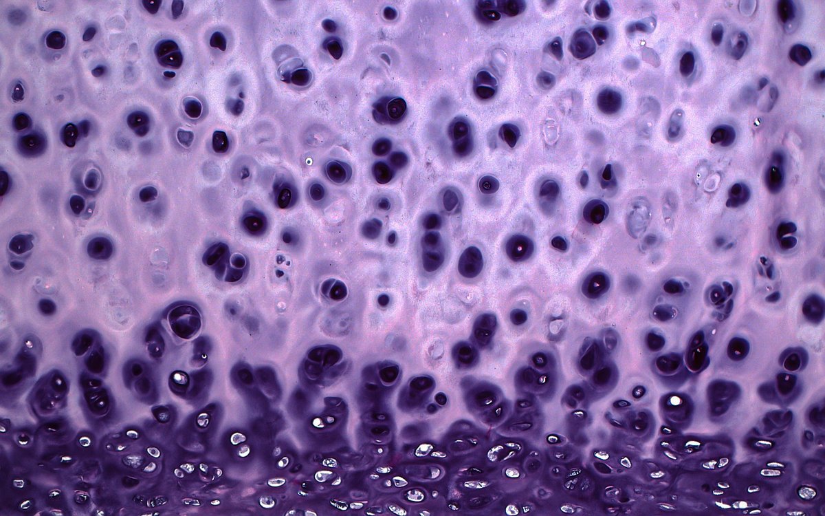 Hyaline Cartilage Under Microscope