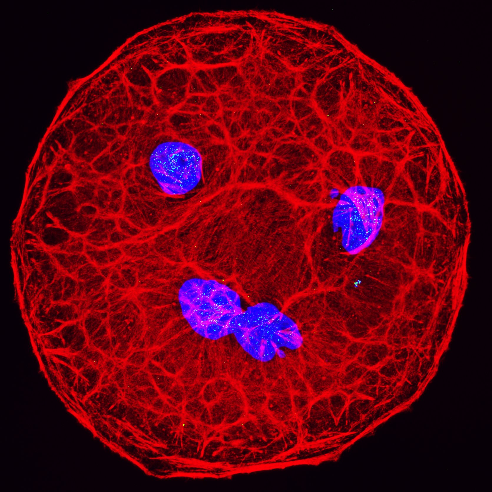 Brain Is Like A Nucleus