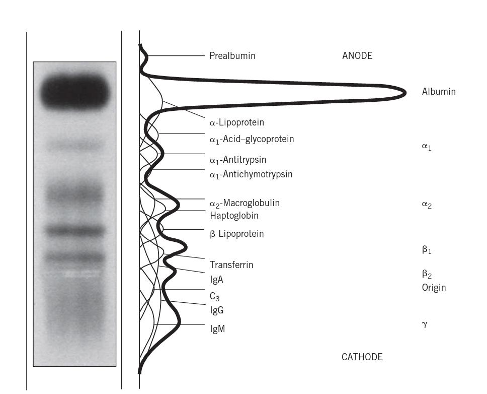 Serum protein electrophoresis test (SPET).. نزلت امس صورة فالبعض طلب ...