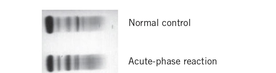 Serum protein electrophoresis test (SPET).. نزلت امس صورة فالبعض طلب ...