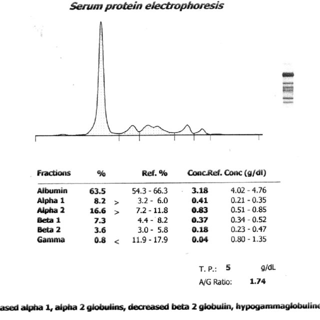 Serum protein electrophoresis test (SPET).. نزلت امس صورة فالبعض طلب ...