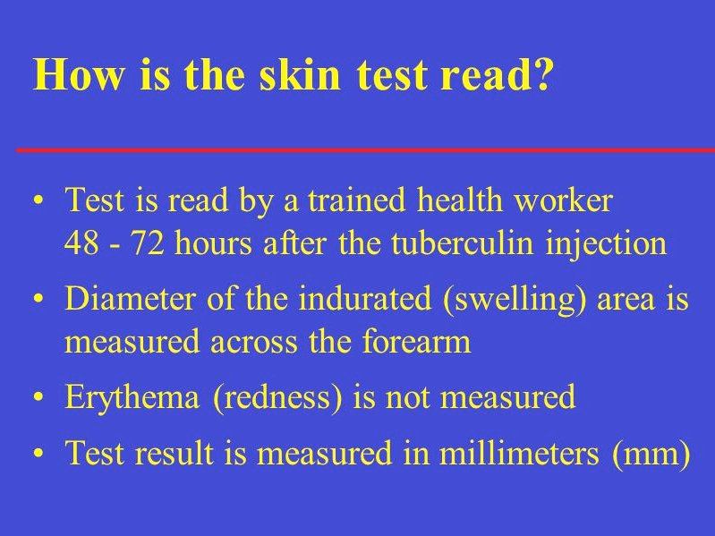 Positive Ppd Induration Size