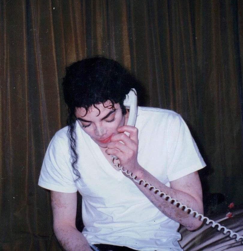 Michael Jackson Vitiligo Hands