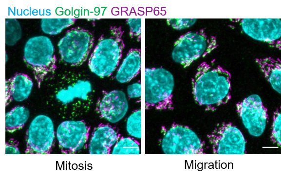 (1/n) After spending four exciting years chasing the golgi, I am happy ...