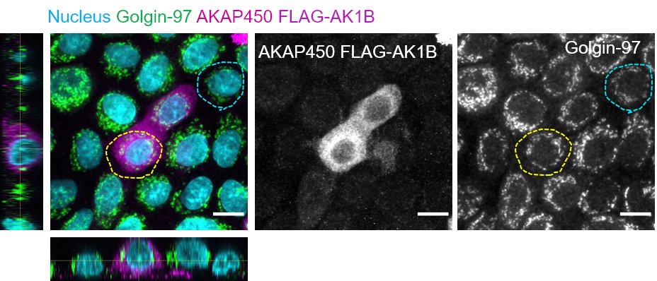 (1/n) After spending four exciting years chasing the golgi, I am happy ...