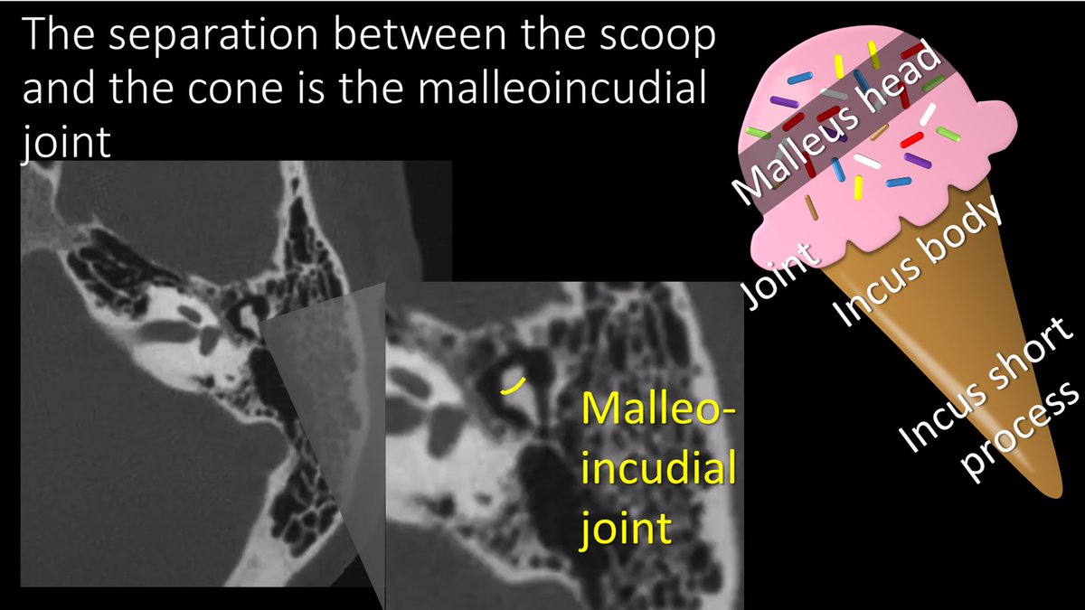 1/ “Now listen carefully!” Does the word “tbone” make you think of a ...