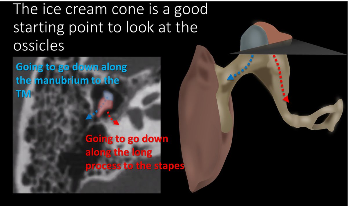 1/ “Now listen carefully!” Does the word “tbone” make you think of a ...