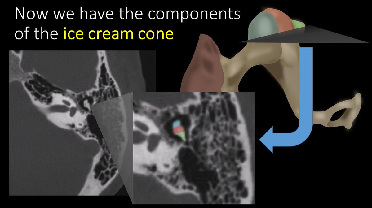 1/ “Now listen carefully!” Does the word “tbone” make you think of a ...