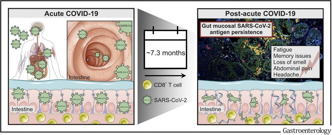 COVID-19: Persistent immune activation, low T-cell counts and infected ...