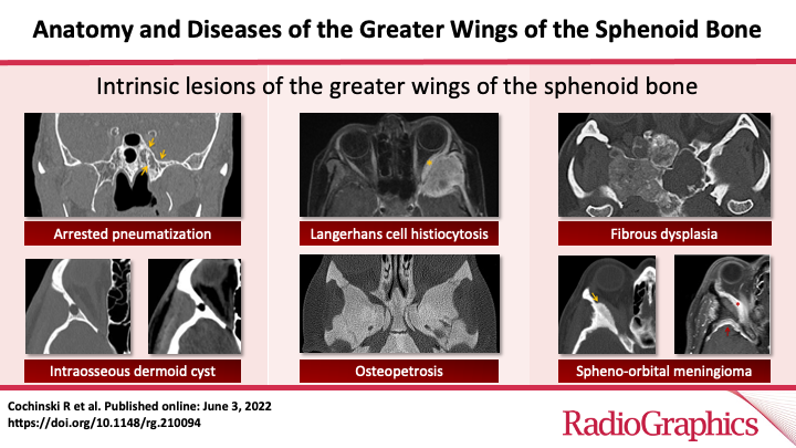 Winged People Anatomy