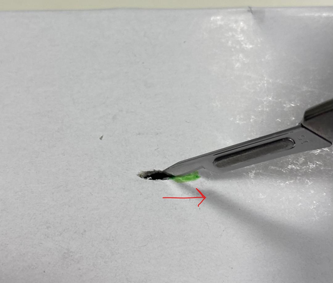 Today's 🧵continues our exploration of scalpel blades with an opinion ...