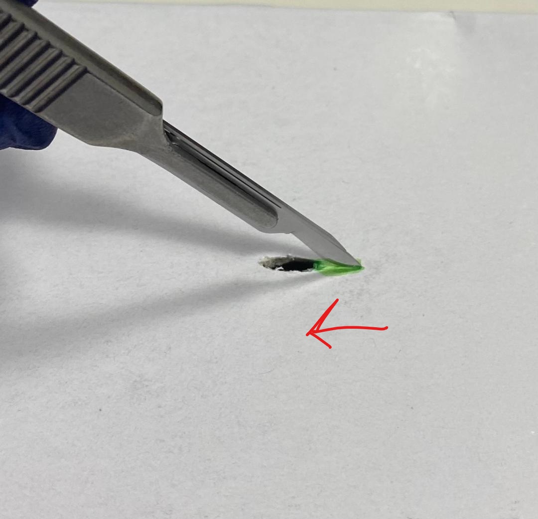 Today's 🧵continues our exploration of scalpel blades with an opinion ...