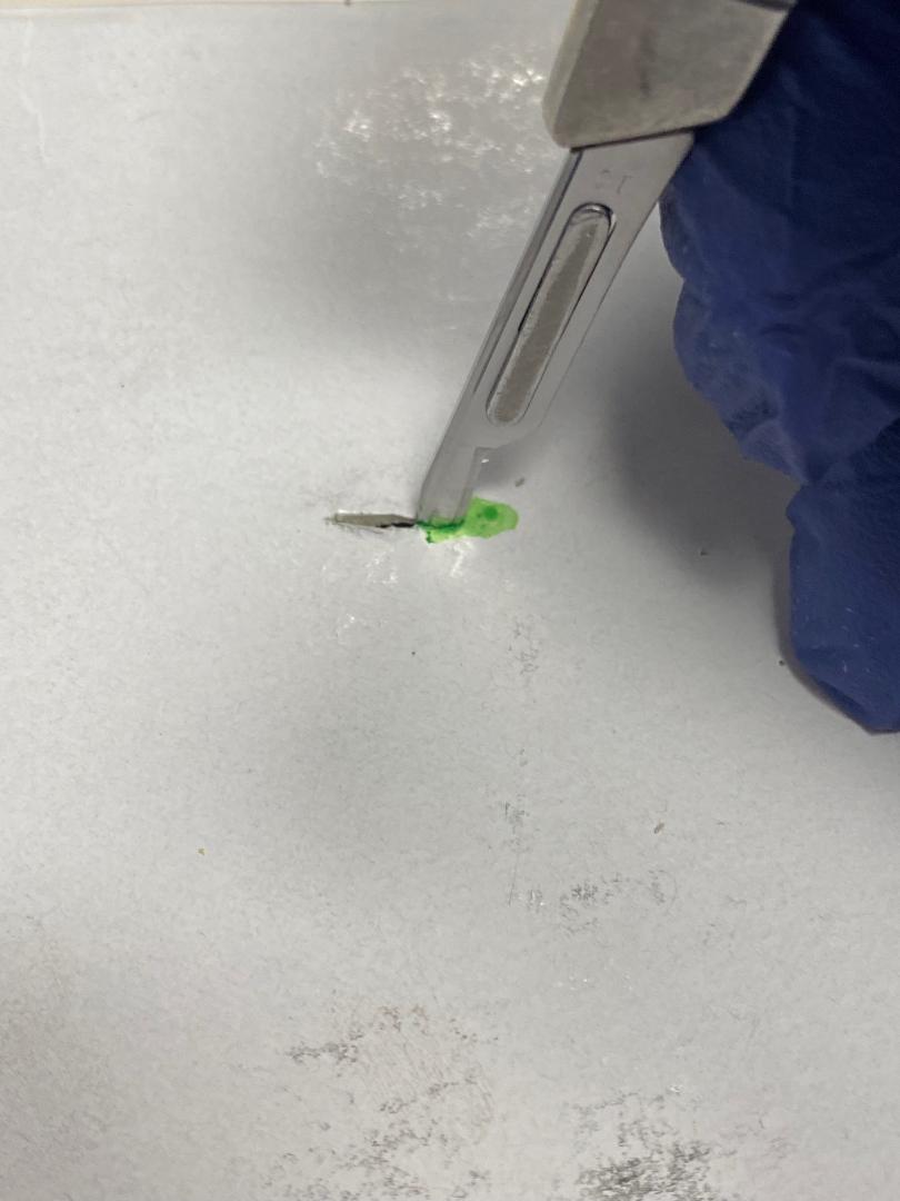 Today's 🧵continues our exploration of scalpel blades with an opinion ...