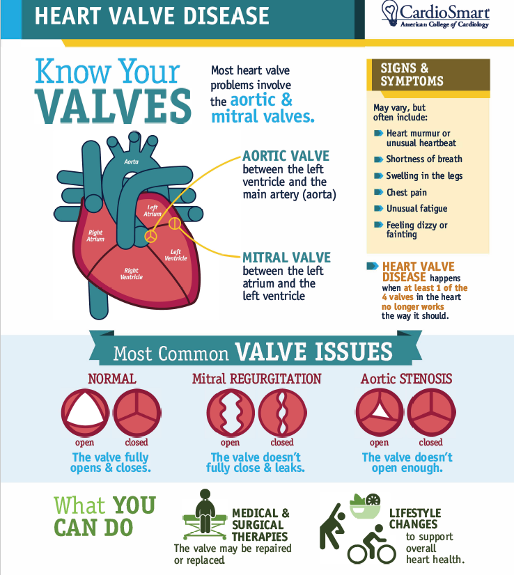 Heart Valve Disease